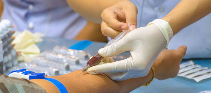 Biaya Tes ANA (Anti Nuclear Antibody) Terbaru - Biaya.Info